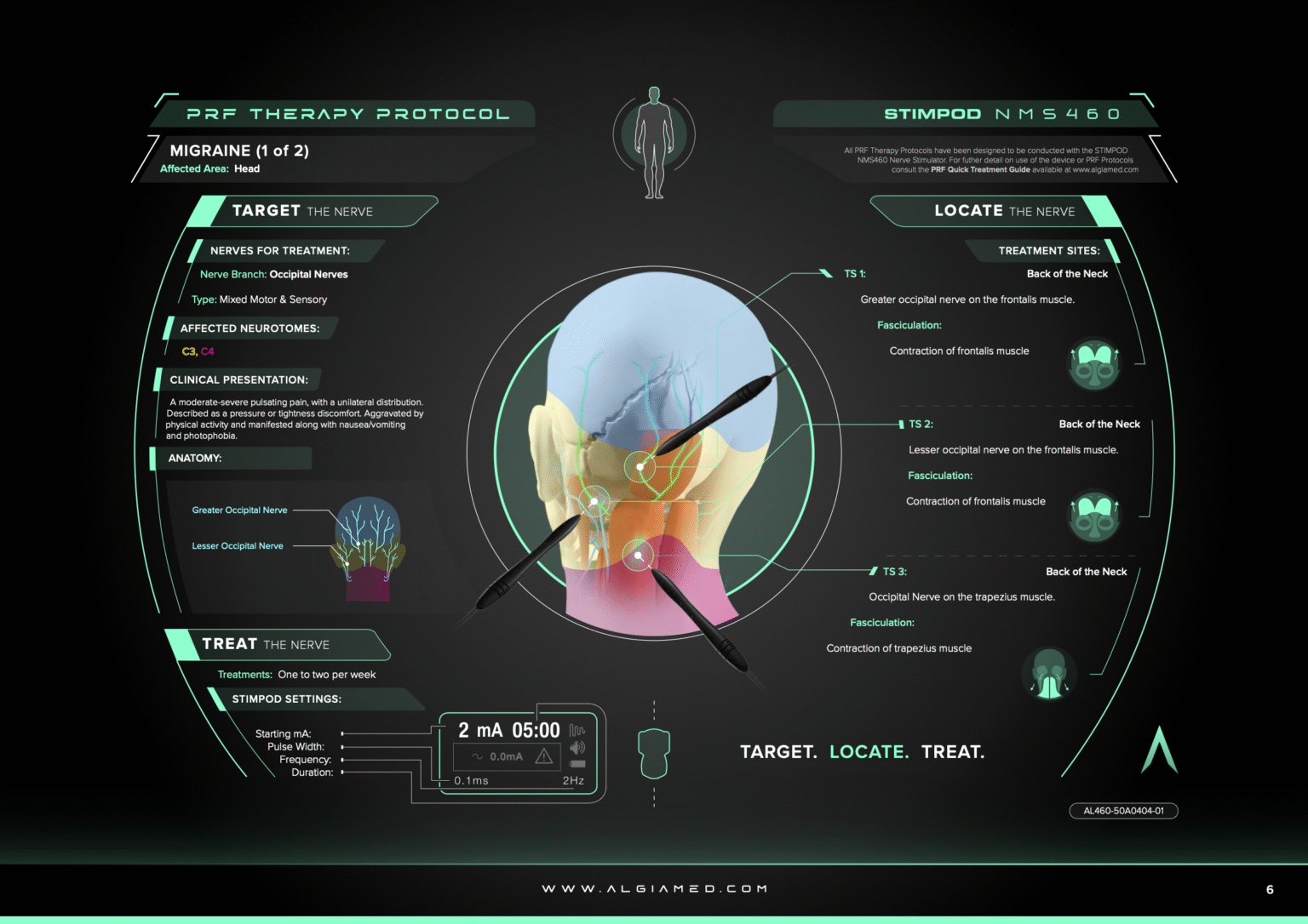 Migraine Solutions with the Stimpod NMS460
